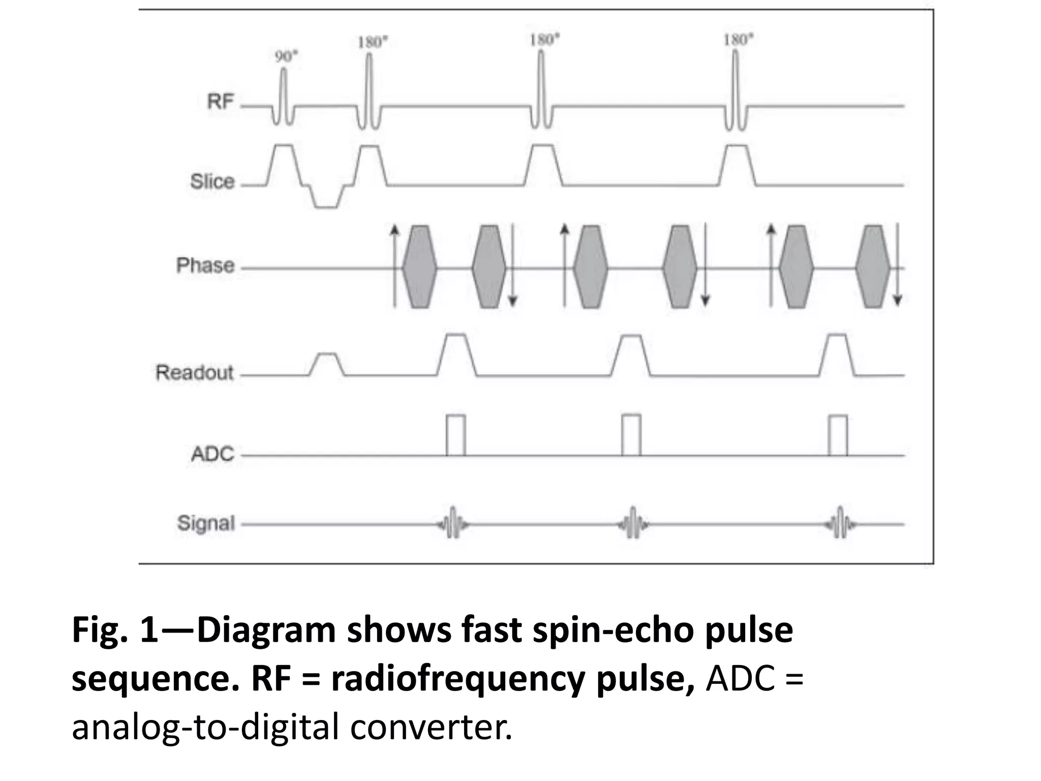 Cardiac MRI | PPT