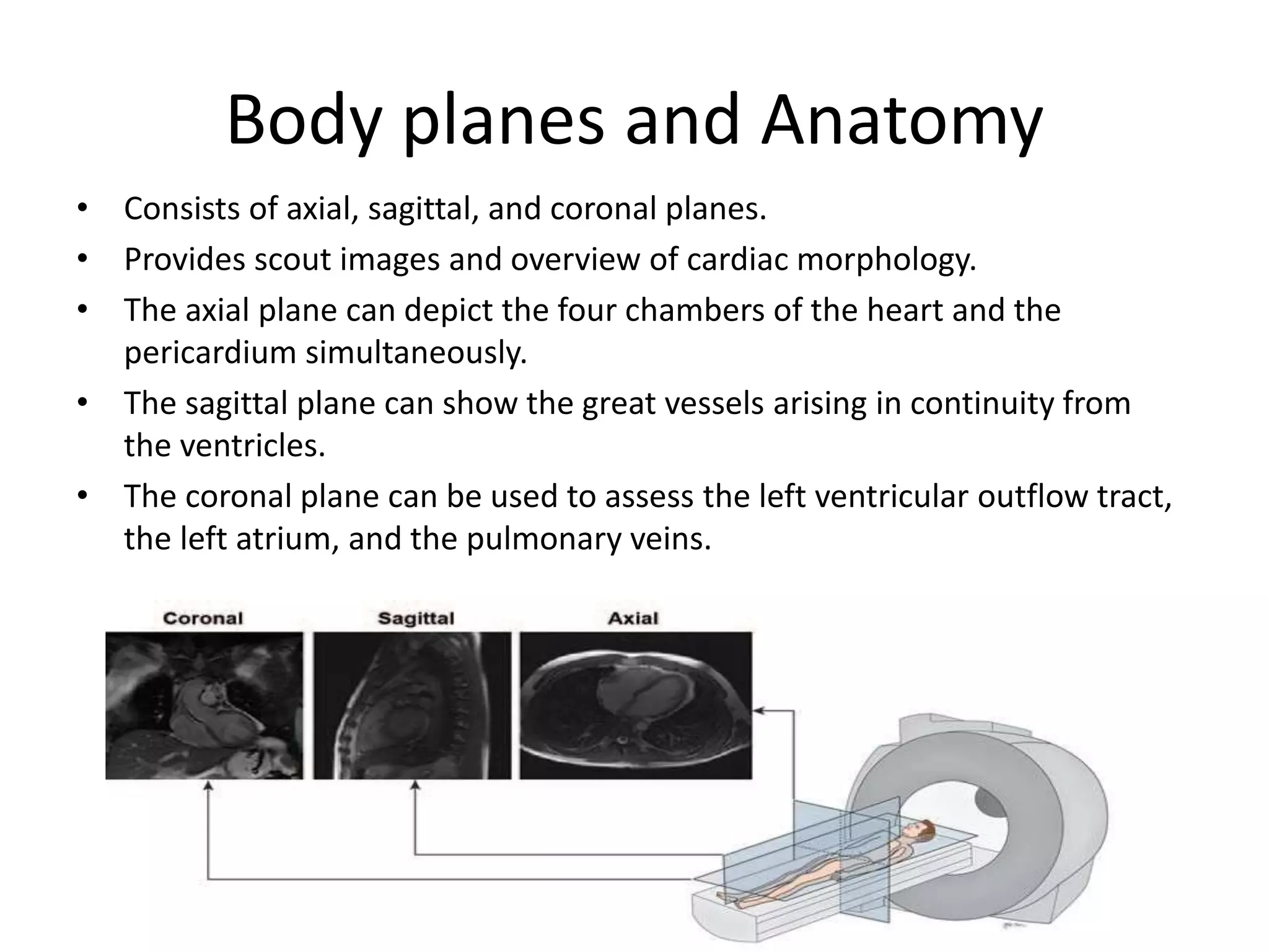 Cardiac MRI | PPT