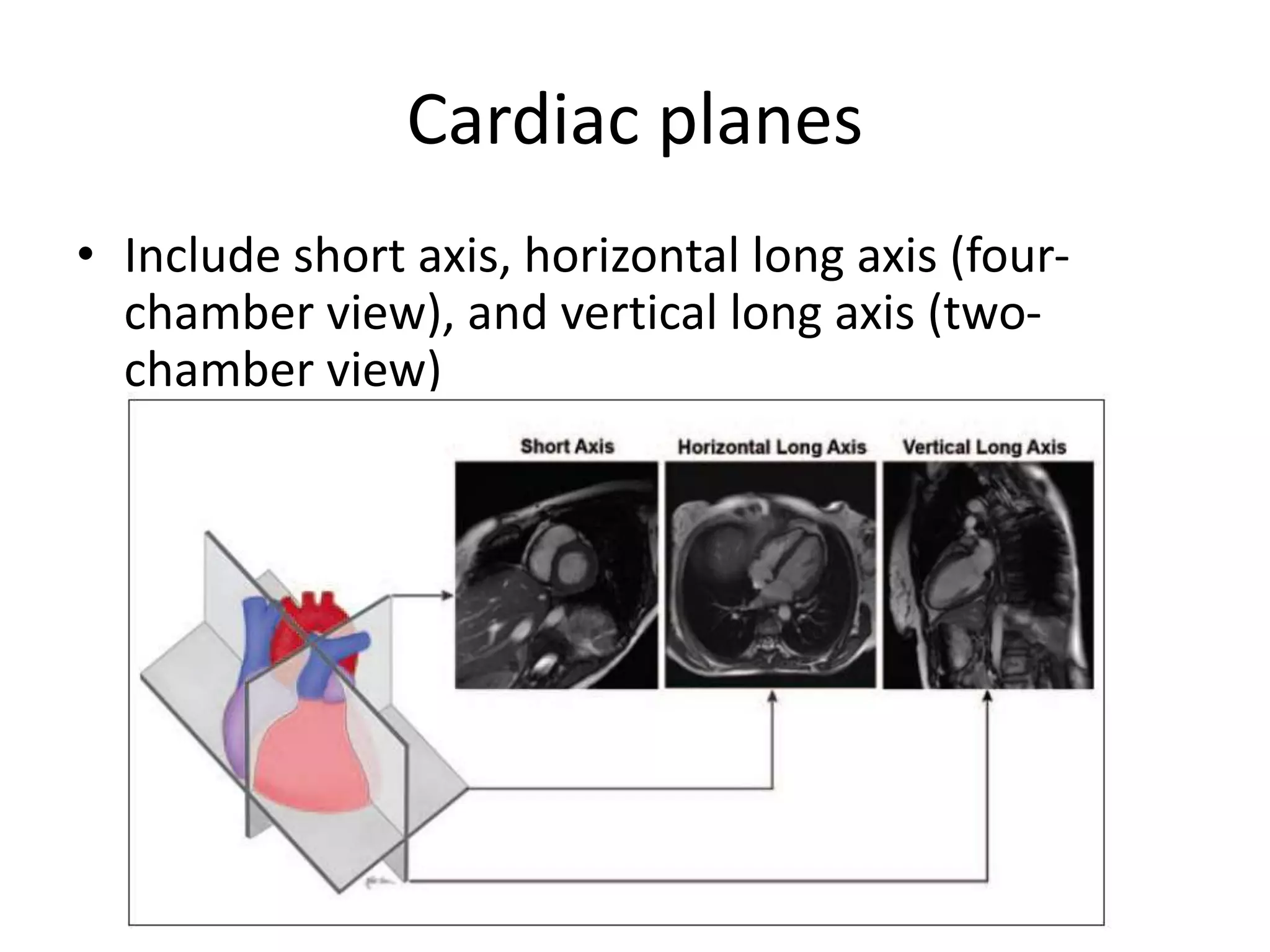 Cardiac MRI | PPT