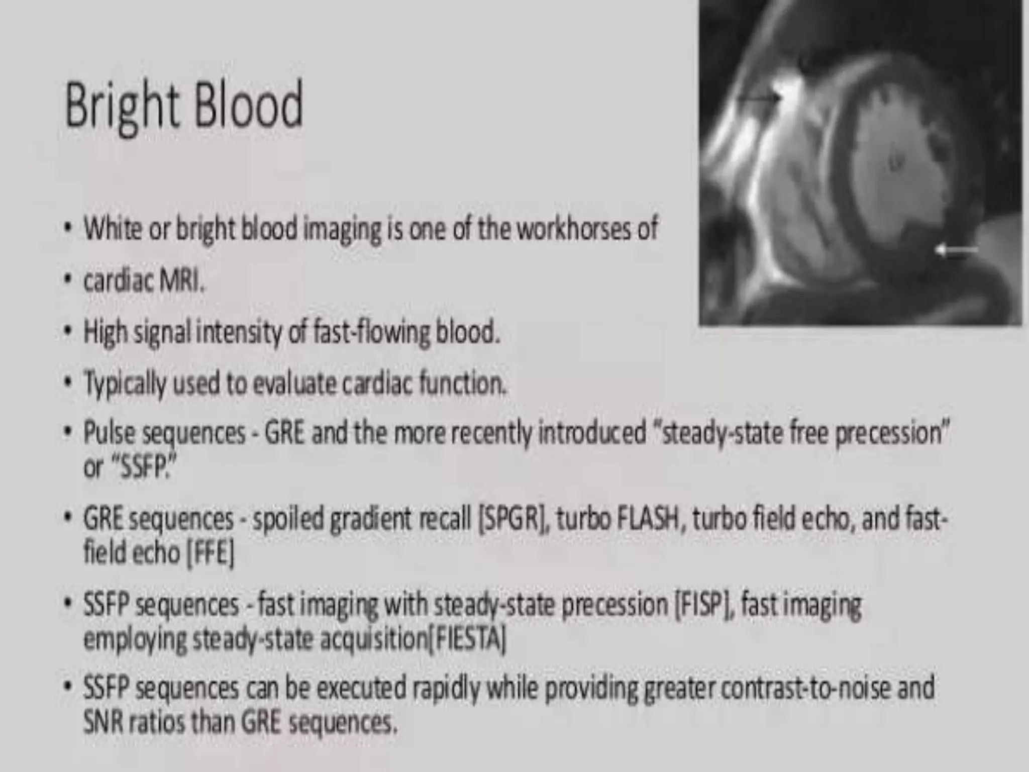Cardiac MRI basics | PPTX