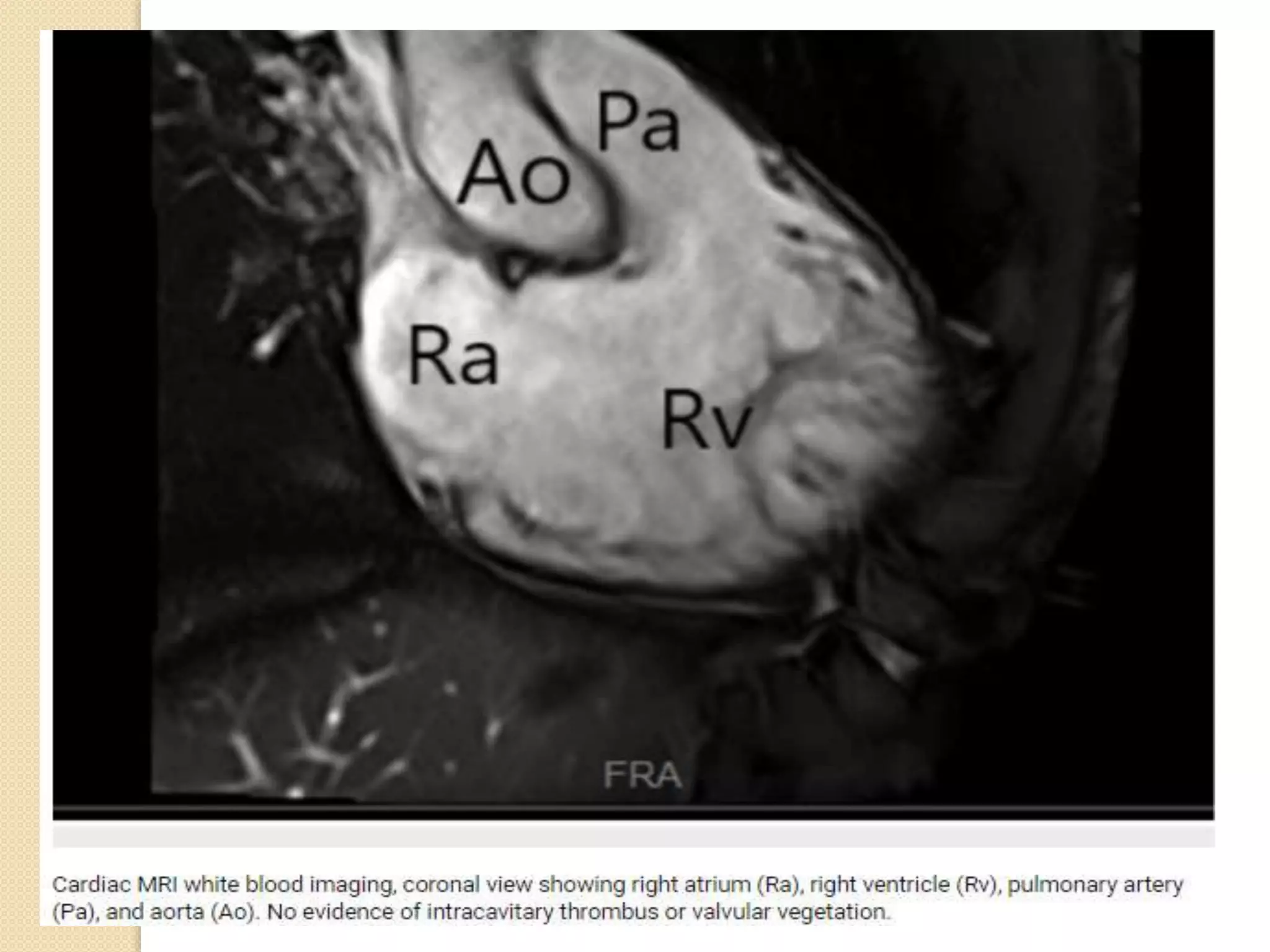 Cardiac MRI basics | PPTX