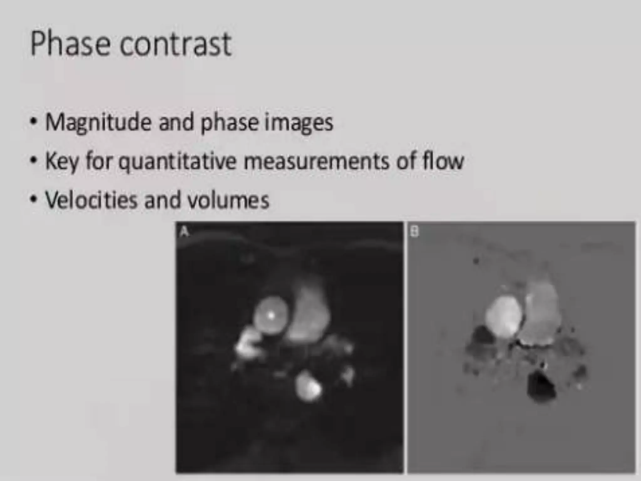 Cardiac MRI basics | PPTX