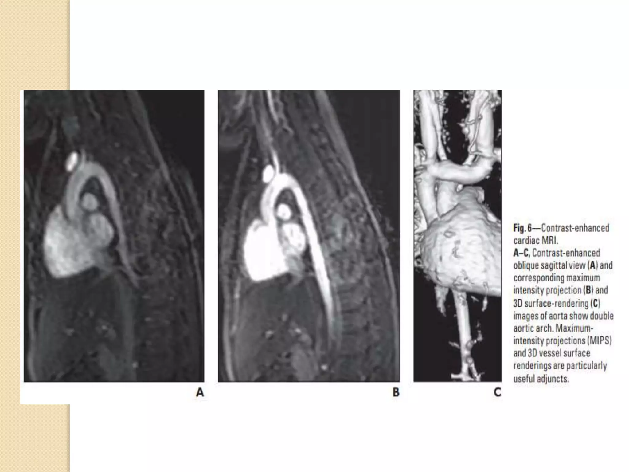 Cardiac MRI basics | PPTX