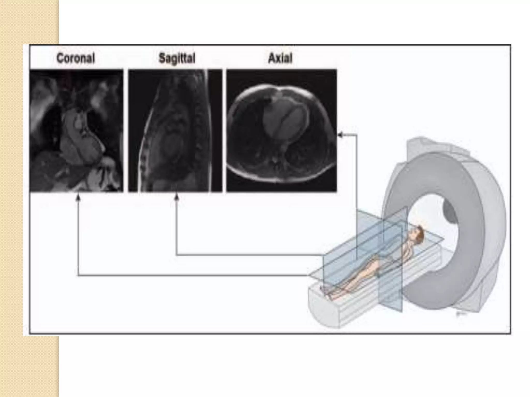 Cardiac MRI basics | PPTX