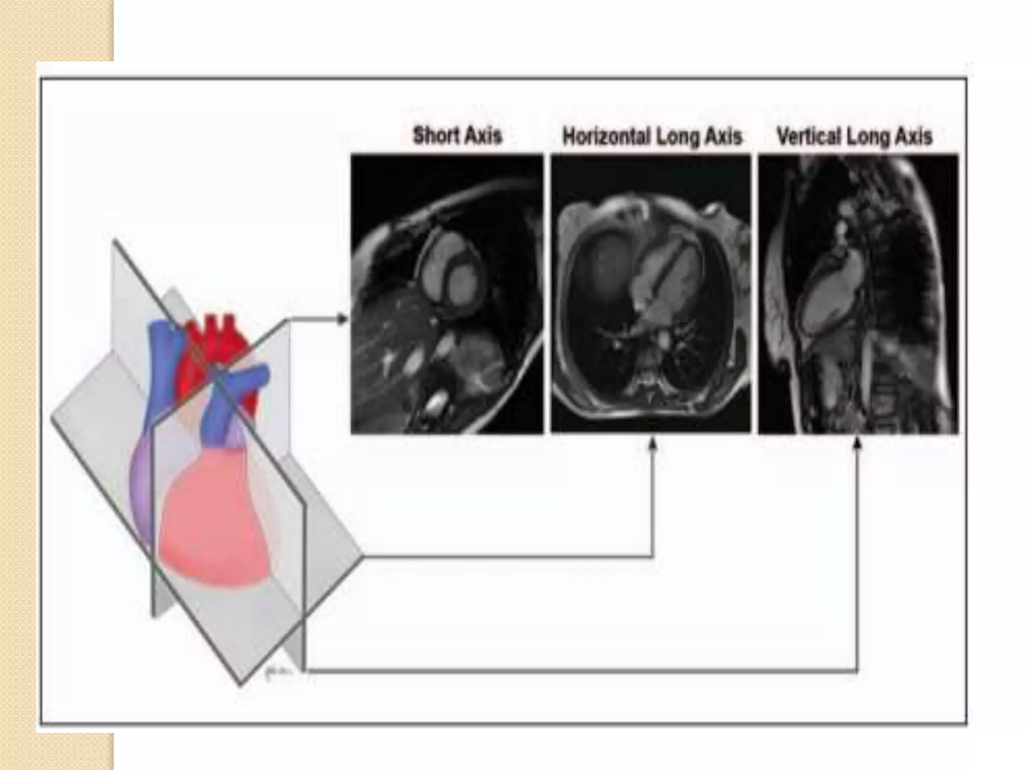 Cardiac MRI basics | PPTX