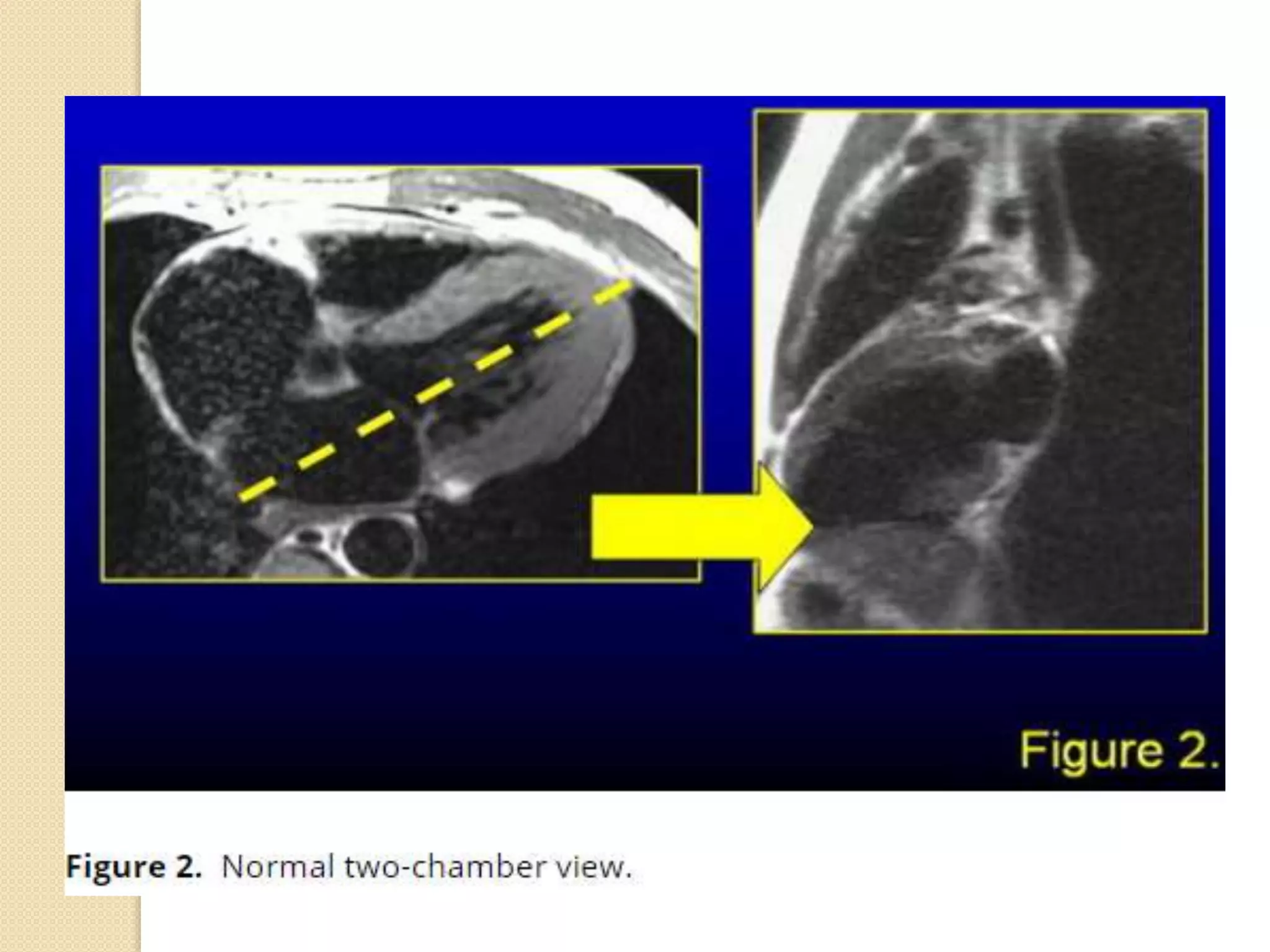 Cardiac MRI basics | PPTX