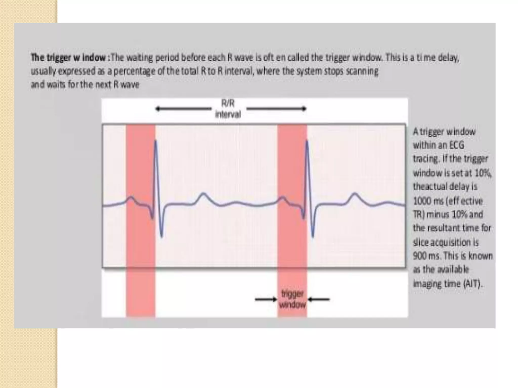 Cardiac MRI basics | PPTX