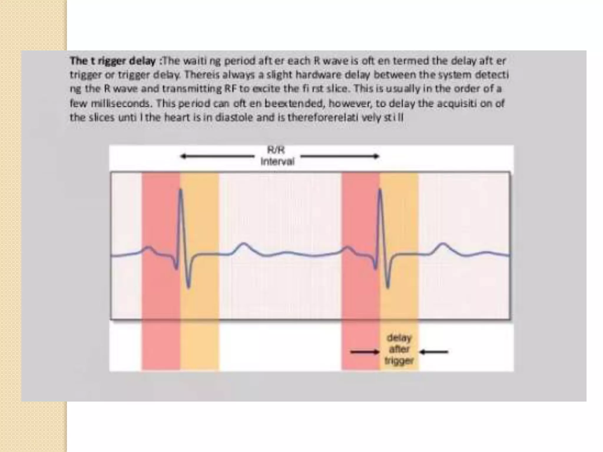 Cardiac MRI basics | PPTX