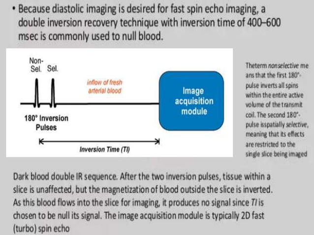 Cardiac MRI basics | PPTX