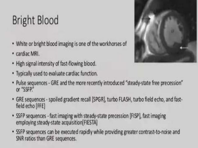 Cardiac MRI basics | PPTX