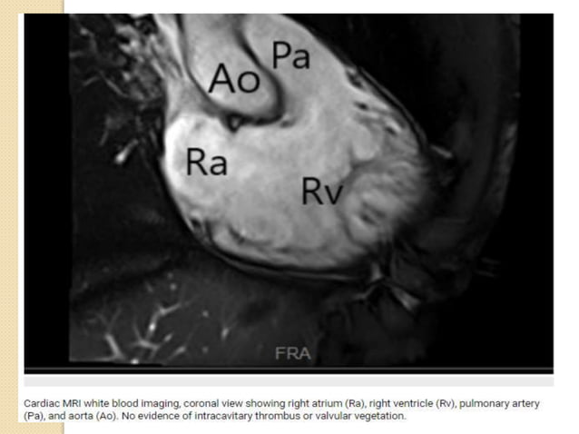 Cardiac MRI basics | PPTX