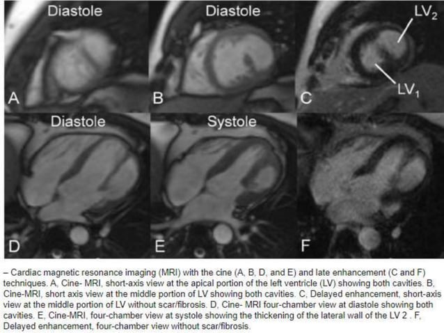 Cardiac MRI basics | PPTX