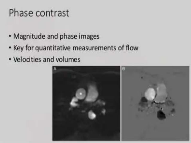 Cardiac MRI basics | PPTX