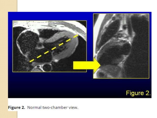 Cardiac MRI basics | PPTX