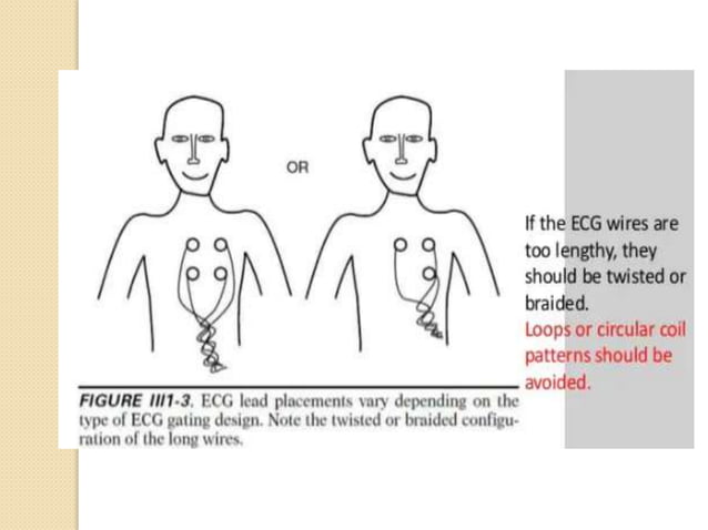 Cardiac MRI basics | PPTX