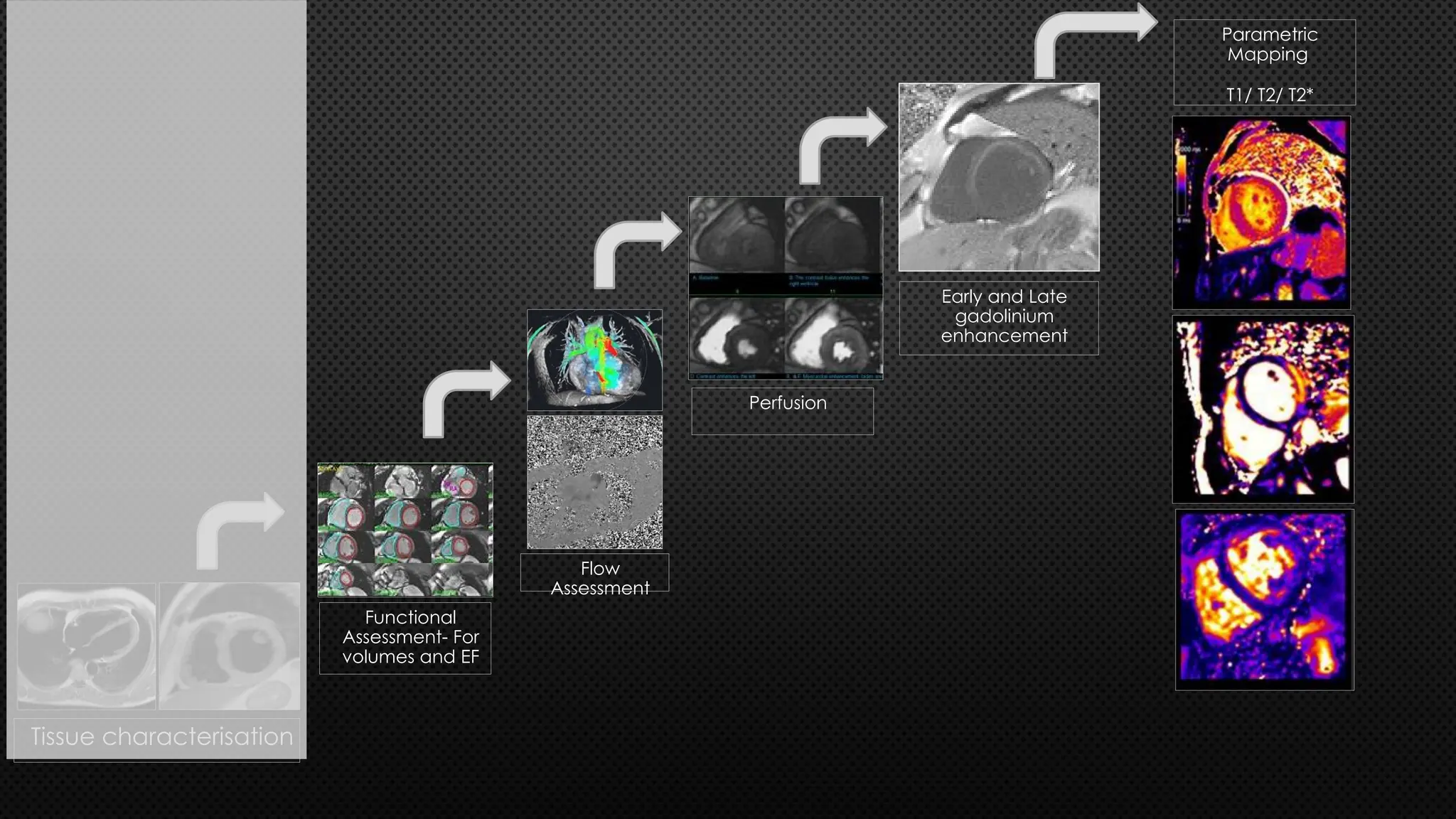 Cardiac MRI basics and interpretation.pptx