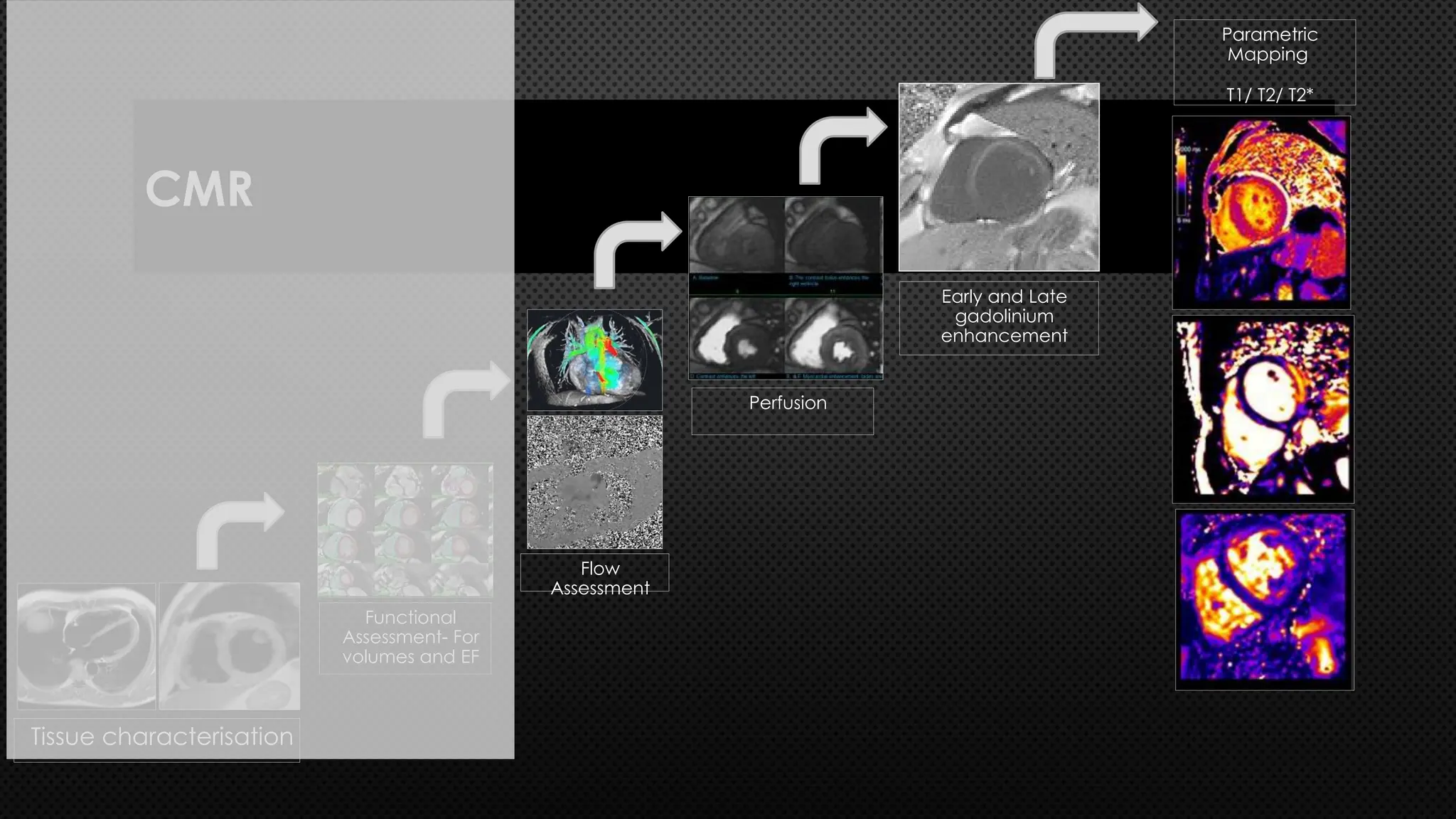 Cardiac MRI basics and interpretation.pptx