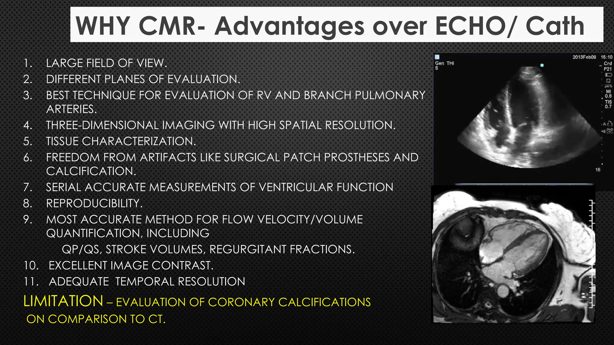 Cardiac MRI basics and interpretation.pptx