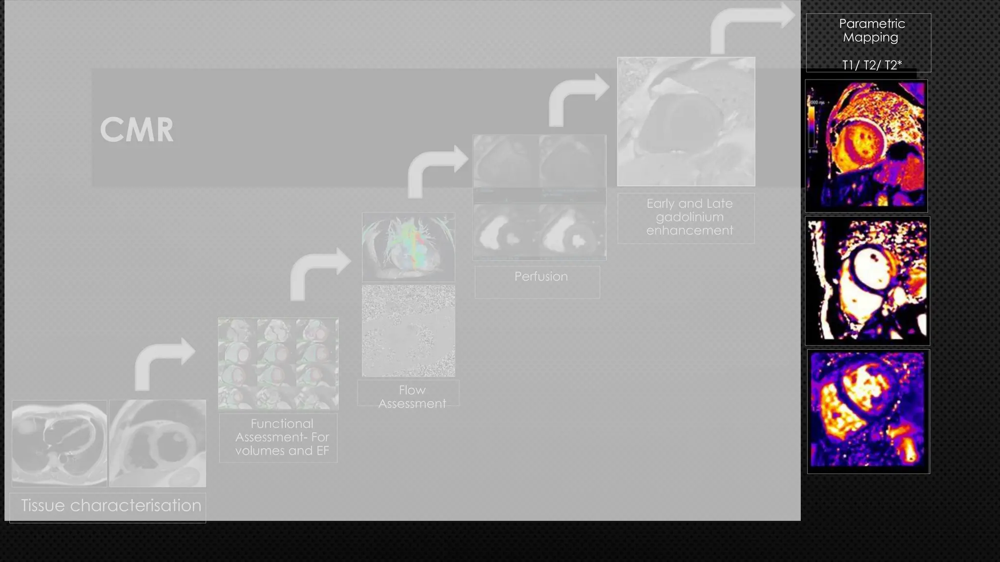 Cardiac MRI basics and interpretation.pptx