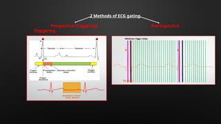 Cardiac MRI basics and interpretation.pptx