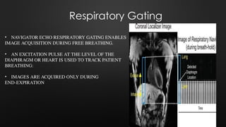 Cardiac MRI basics and interpretation.pptx