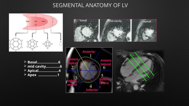 Cardiac MRI basics and interpretation.pptx