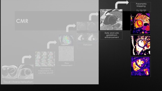 Cardiac MRI basics and interpretation.pptx