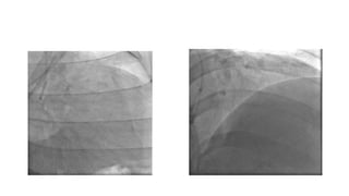 Cardiac MRI: Principles and Clinical Applications | PPTX