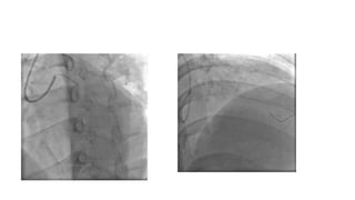 Cardiac MRI: Principles and Clinical Applications | PPTX