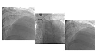 Cardiac MRI: Principles and Clinical Applications | PPTX