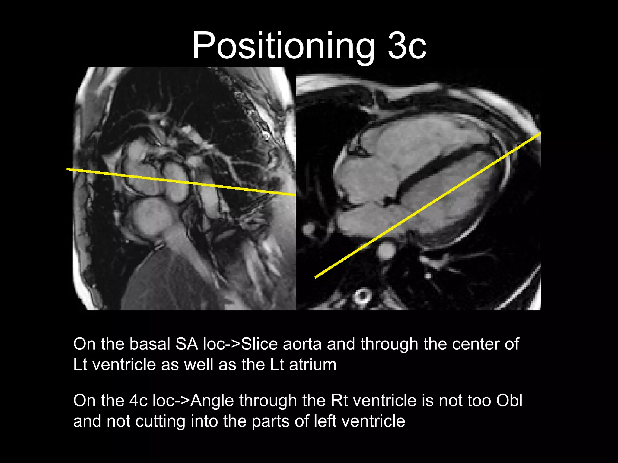 Cardiac mri&slice anatomy | PPT