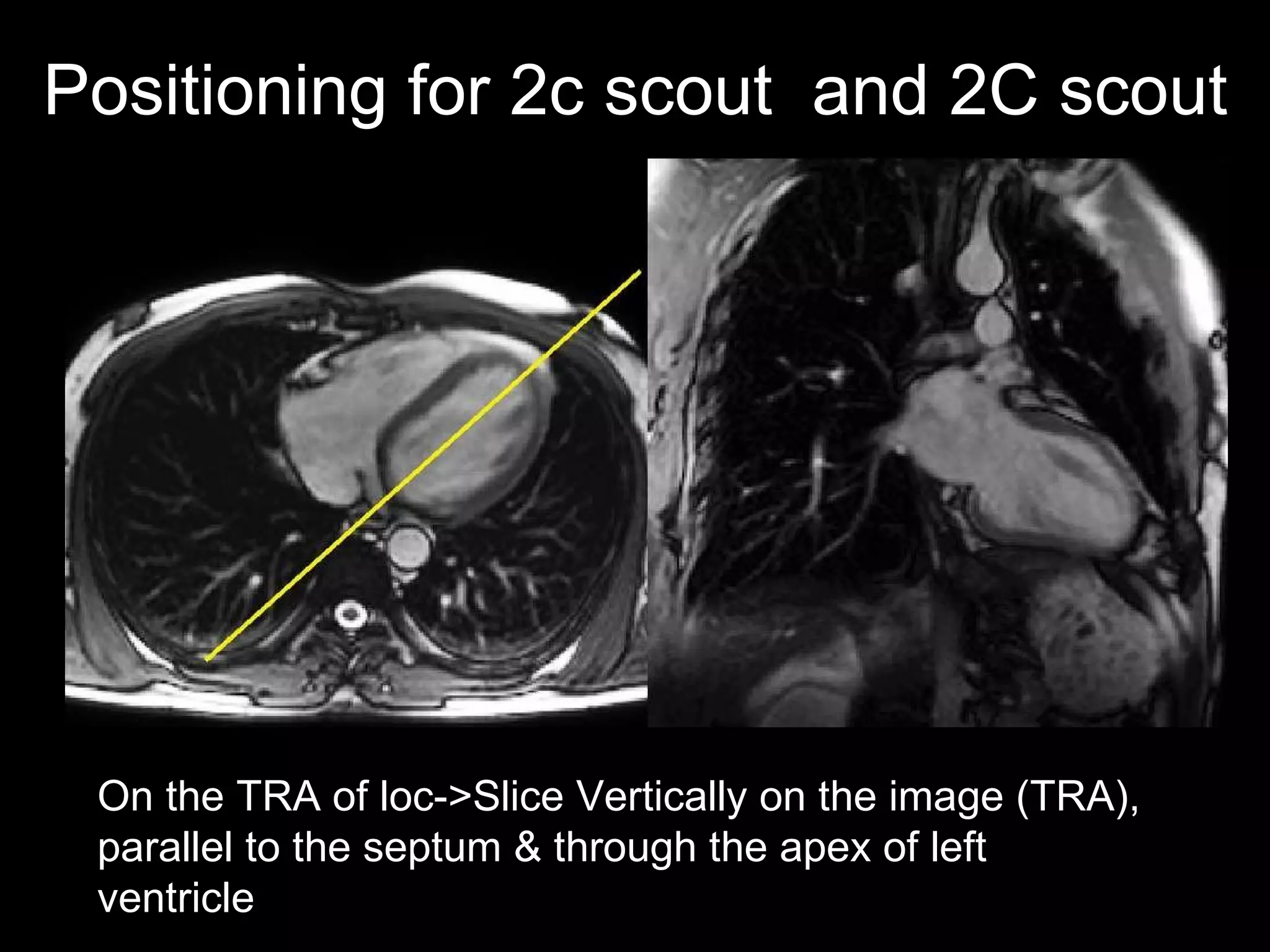 Cardiac mri&slice anatomy | PPT