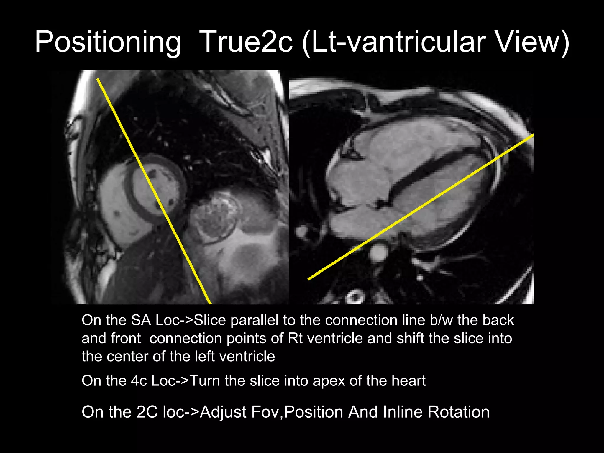 Cardiac mri&slice anatomy | PPT