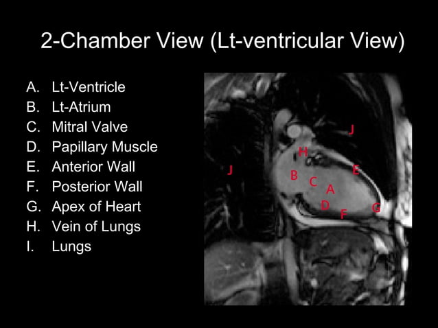 Cardiac mri&slice anatomy | PPT | Heart and Cardiovascular Diseases ...
