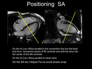 Cardiac mri&slice anatomy | PPT