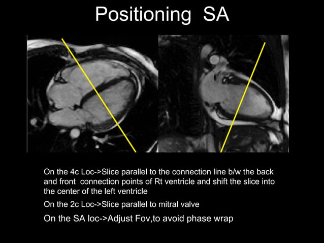 Cardiac mri&slice anatomy | PPT | Heart and Cardiovascular Diseases ...