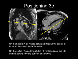 Cardiac mri&slice anatomy | PPT