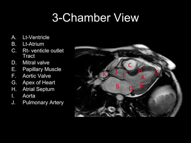 Cardiac mri&slice anatomy | PPT | Heart and Cardiovascular Diseases ...