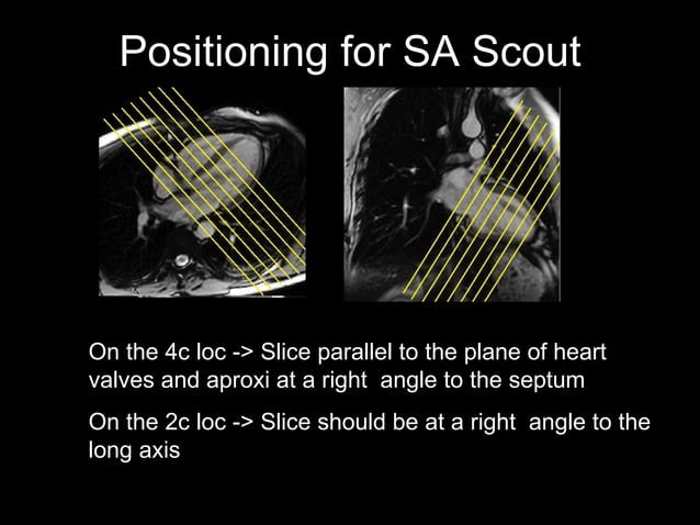 Cardiac mri&slice anatomy | PPT | Heart and Cardiovascular Diseases ...