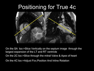 Cardiac mri&slice anatomy | PPT