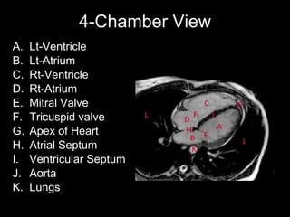 Cardiac mri&slice anatomy | PPT