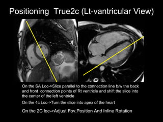 Cardiac mri&slice anatomy | PPT