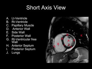 Cardiac mri&slice anatomy | PPT