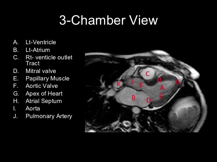 Cardiac mri&slice anatomy