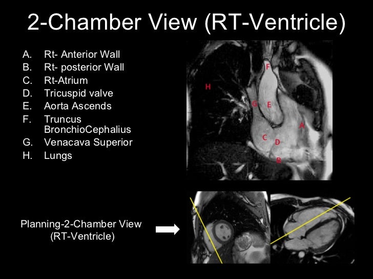 Cardiac mri&slice anatomy
