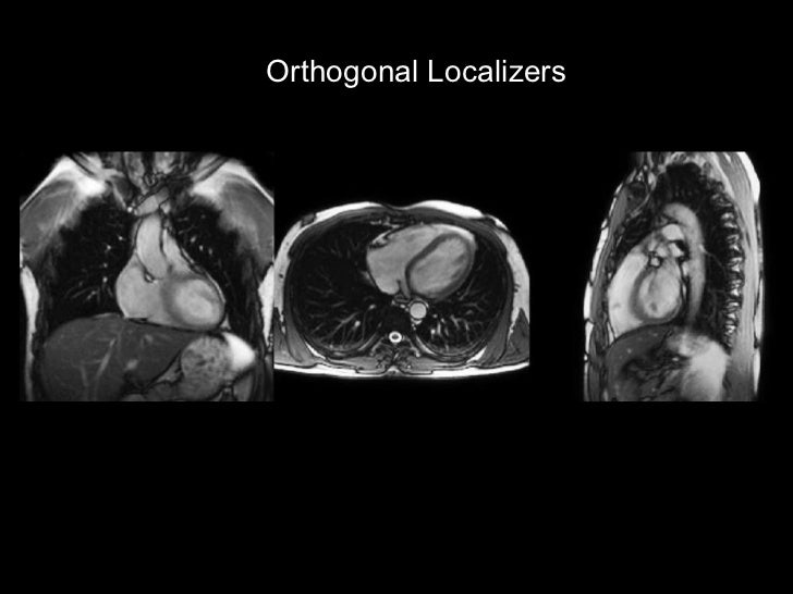 Mri Cardiac Anatomy