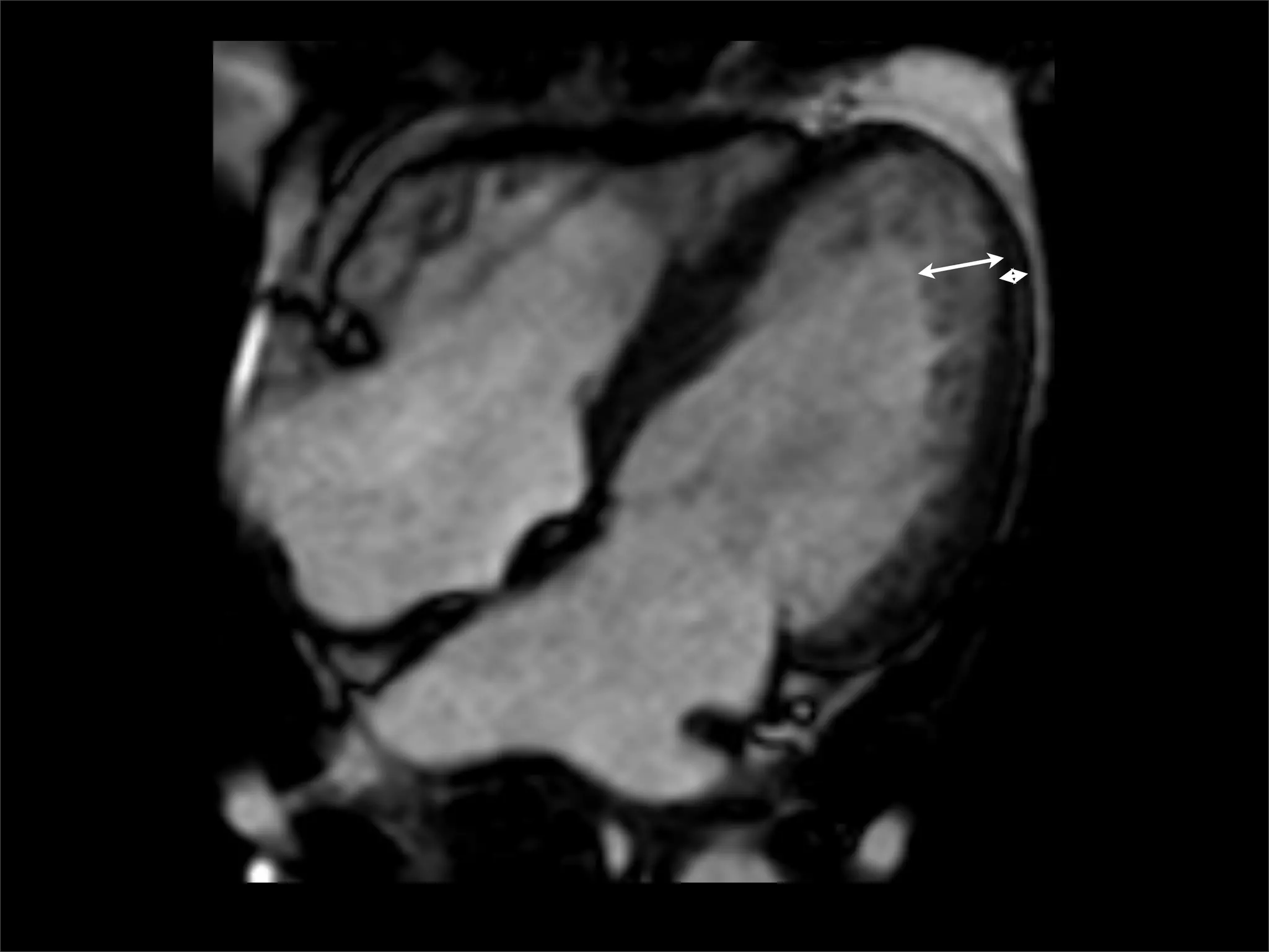 Cardiac mr sequences | PDF