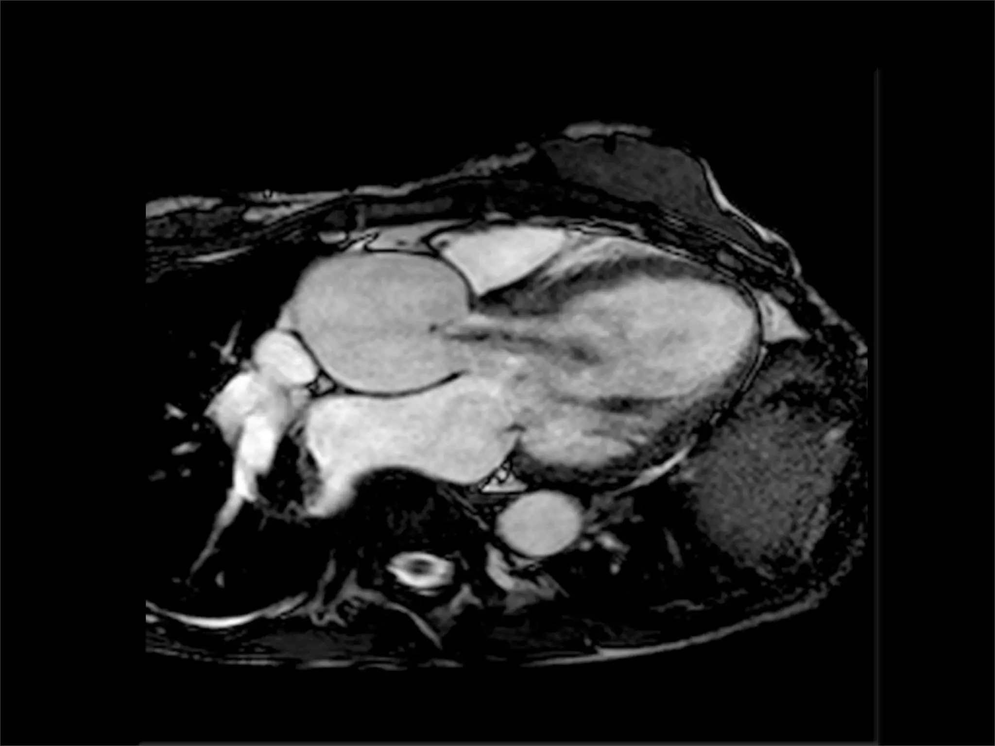 Cardiac mr sequences | PDF