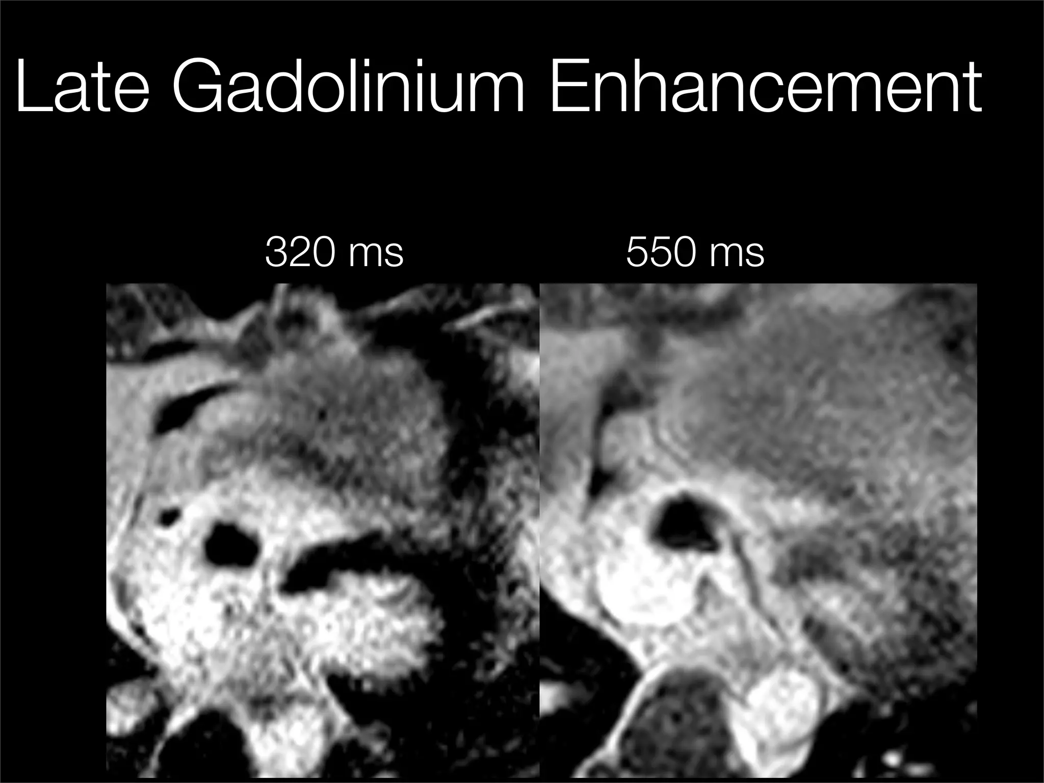 Cardiac mr sequences | PDF