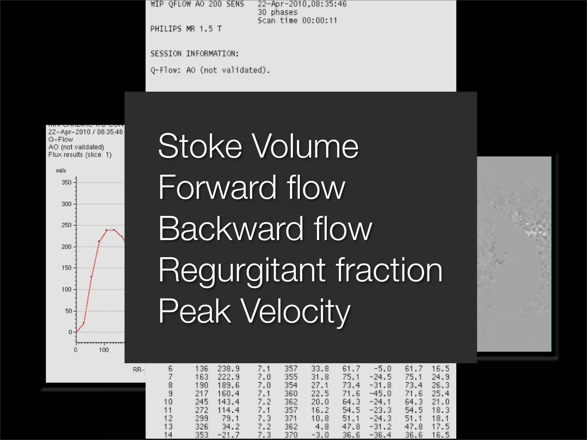 Cardiac mr sequences | PDF